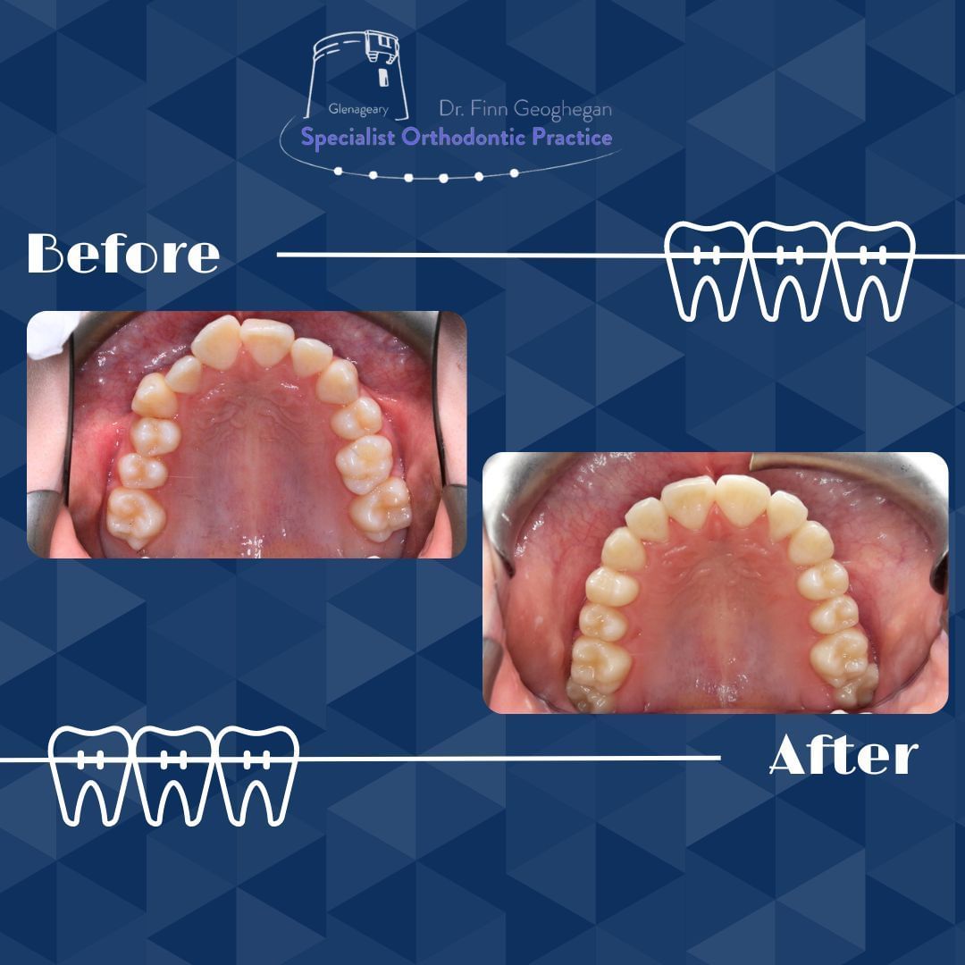 Specialist Orthodontic Practice Home Glenageary Specialist